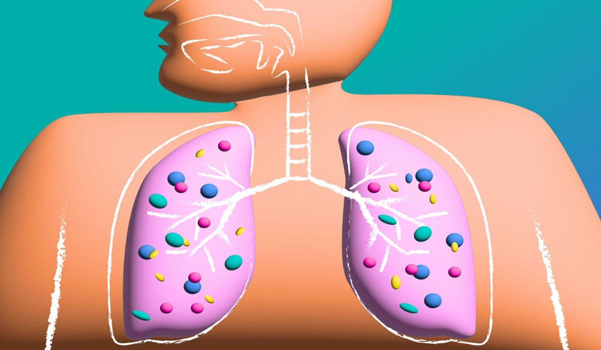 Obesity Lungs