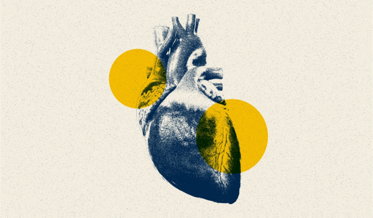 How Common is Pacemaker Use after Heart Valve Surgery? - Alumni ...